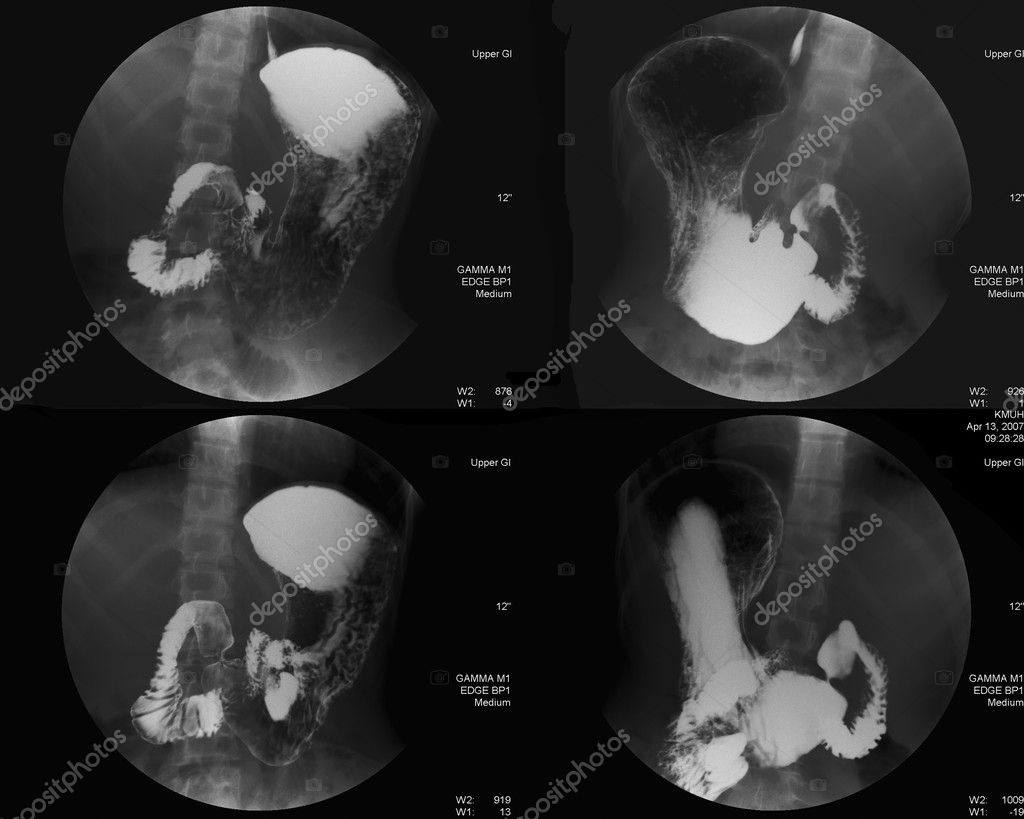 Stomach Radiology — Stock Photo © shiyali #1940265