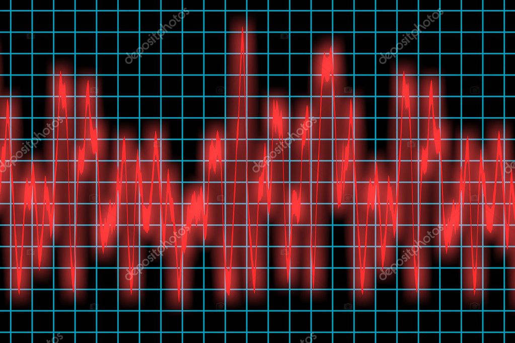 Heart monitor Stock Photo by ©clearviewstock 1214697