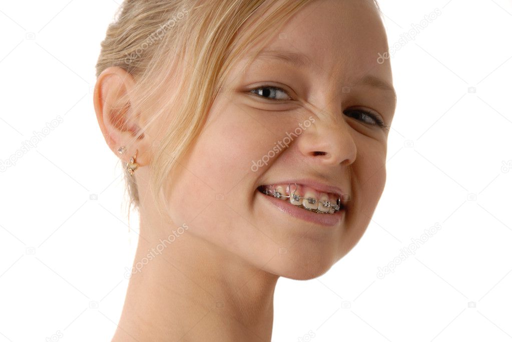 Straight teeth — Stock Photo © ffotograff65 #1116094