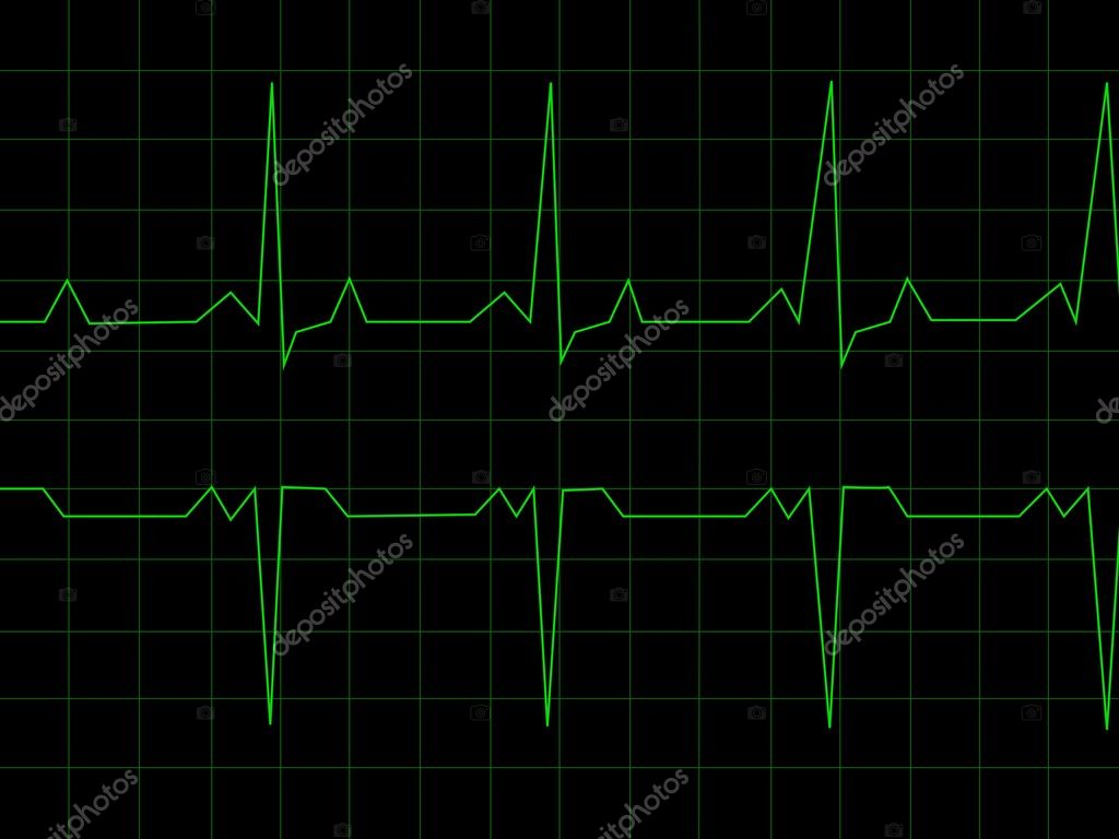 Normal Heart Rhythm — Stock Photo © hlehnerer #1970070