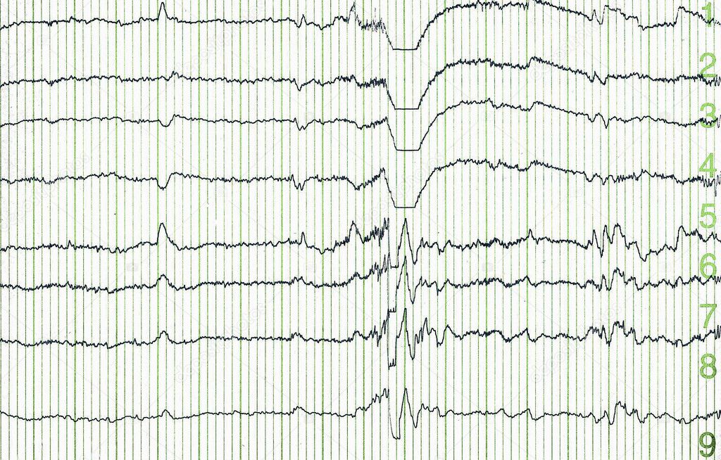 Electro-encephalogramme — Photographie cynoclub © #2337745