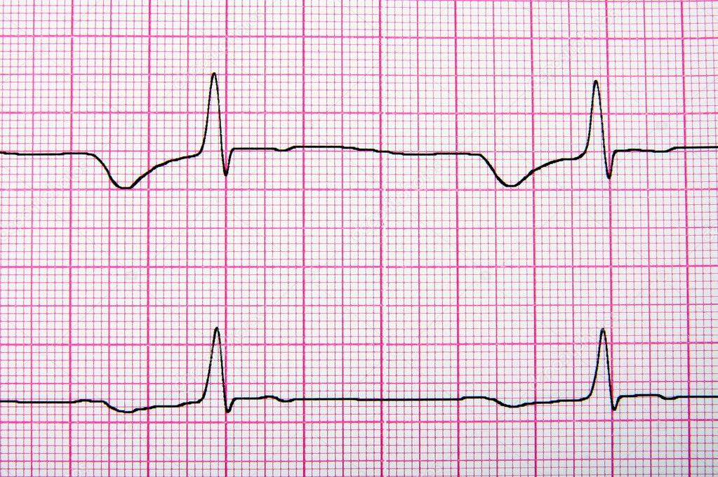 Ecg graph — Stock Photo © tkemot #2305966